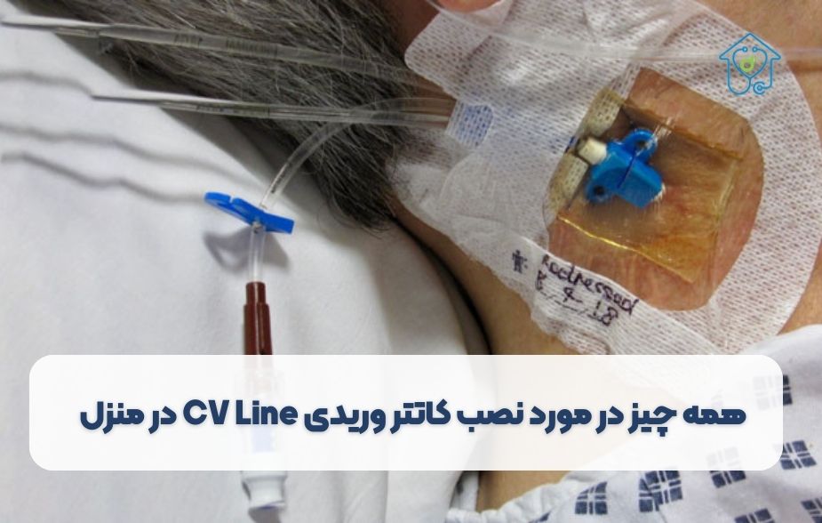 نصب کاتتر وریدی CVC Line در منزل توسط پزشک به صورت 24 ساعته